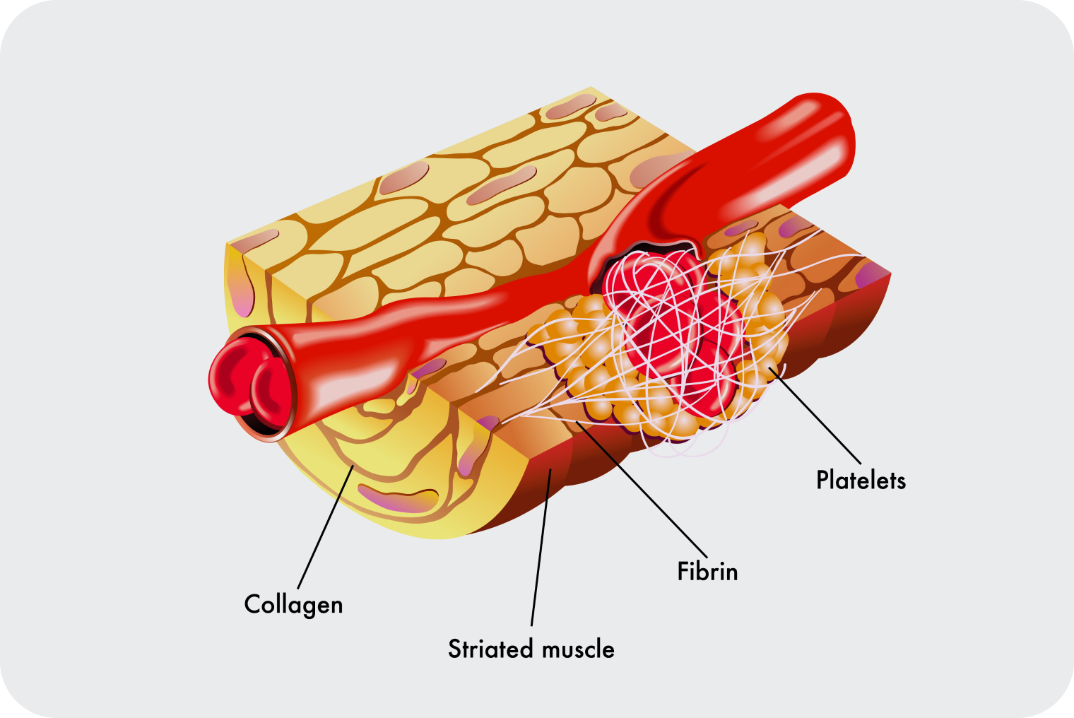 Protrombinový čas - LabIn - Institut laboratorní medicíny